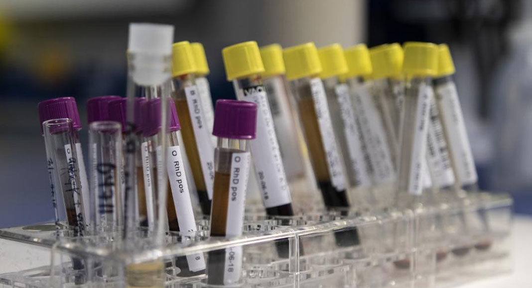 Un Análisis De Sangre Podría Detectar Cáncer Antes De Que Aparezcan